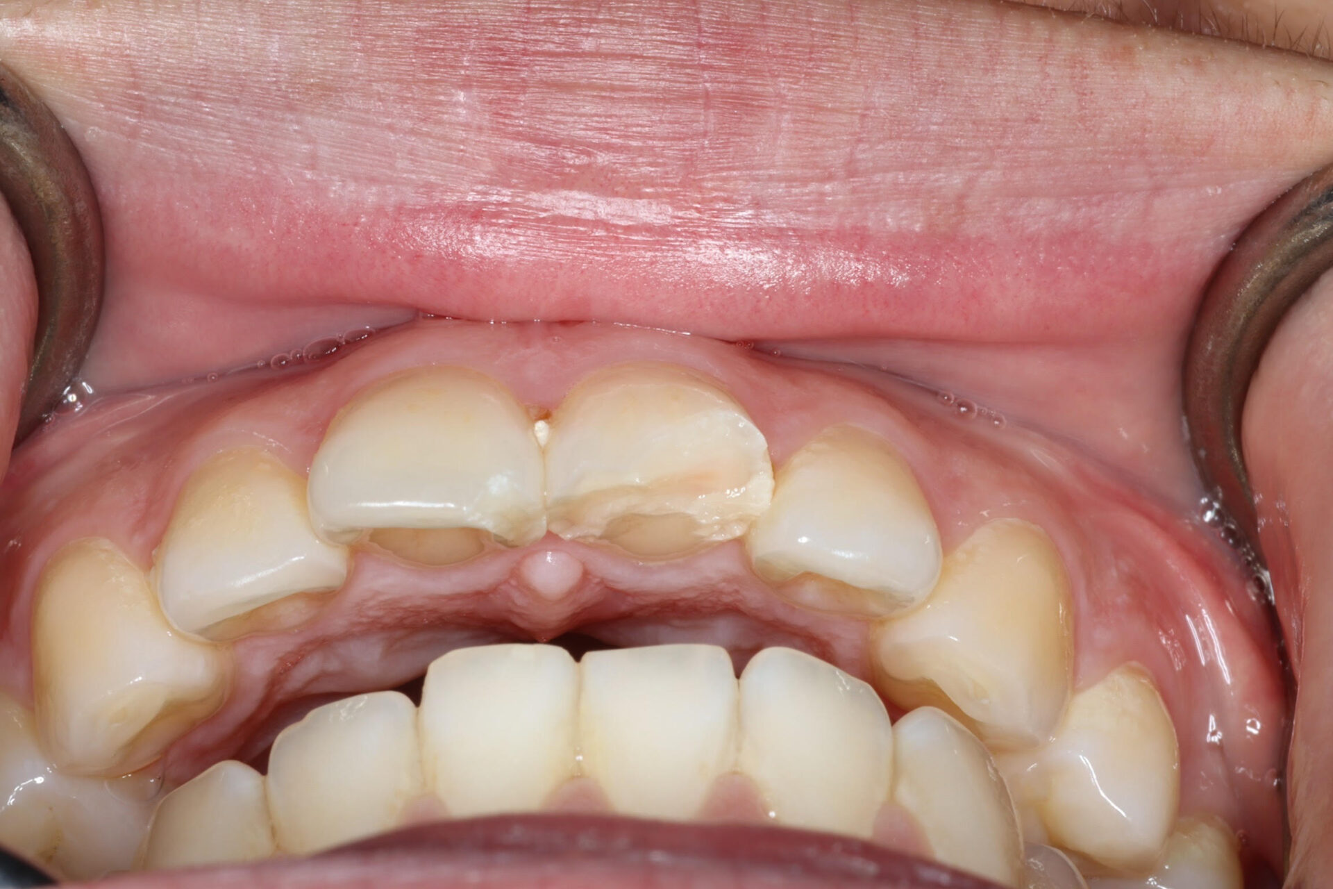 Playing defense with teeth - IGNITEDDS