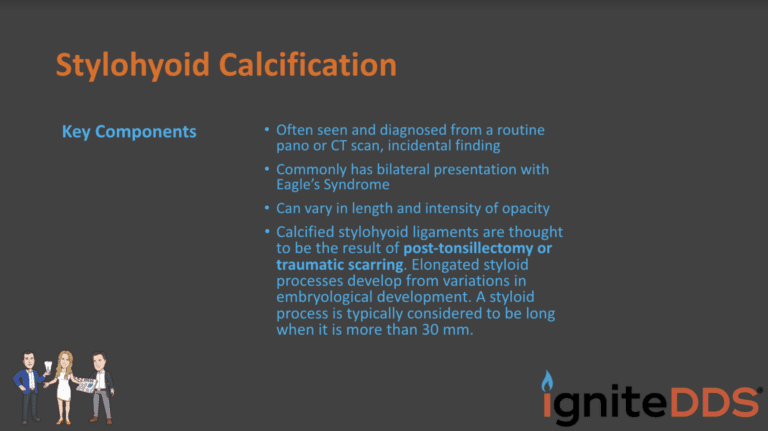 Stylohyoid Calcification: Case Study | IGNITEDDS
