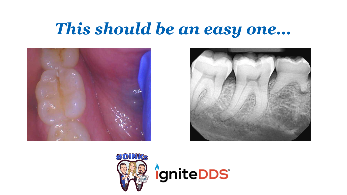 This Should Be An Easy One (dental Case Study)