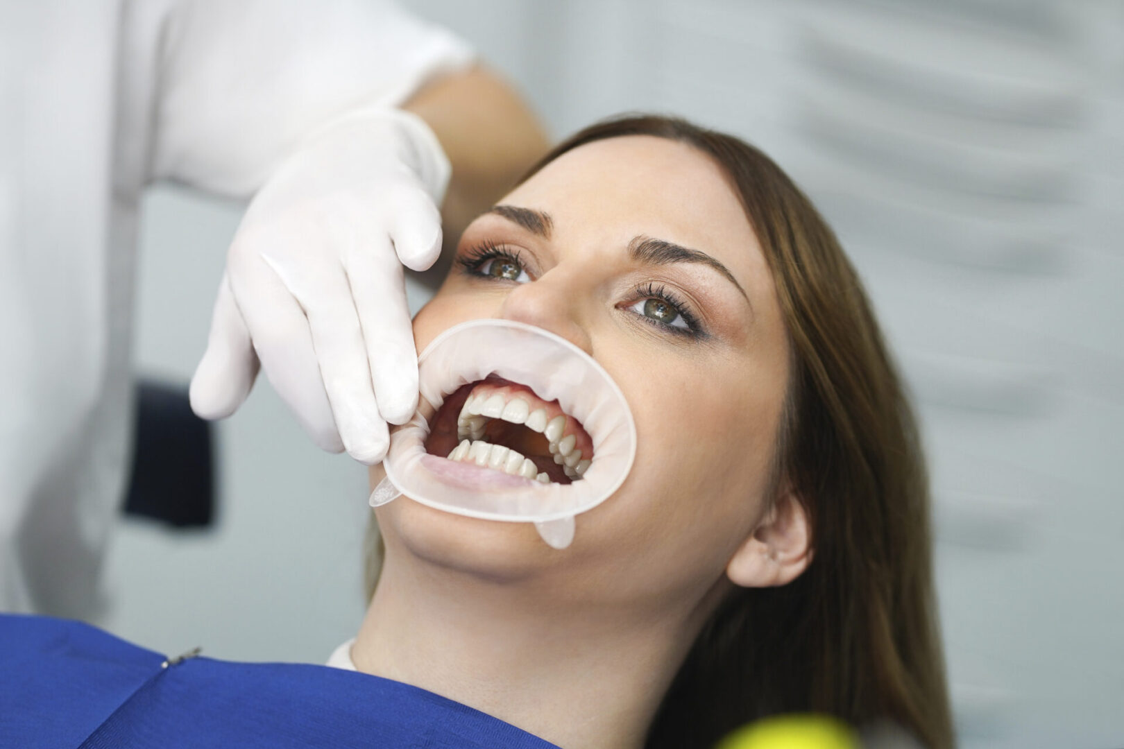 OptraGate® 2 Brings Comfort and Efficiency to the Dental Practice