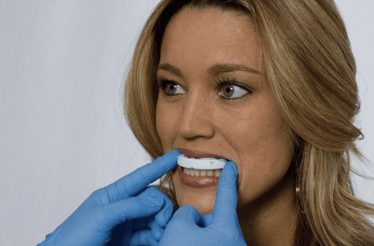 QuickSplint: Predictable Diagnostics and Restorative Success